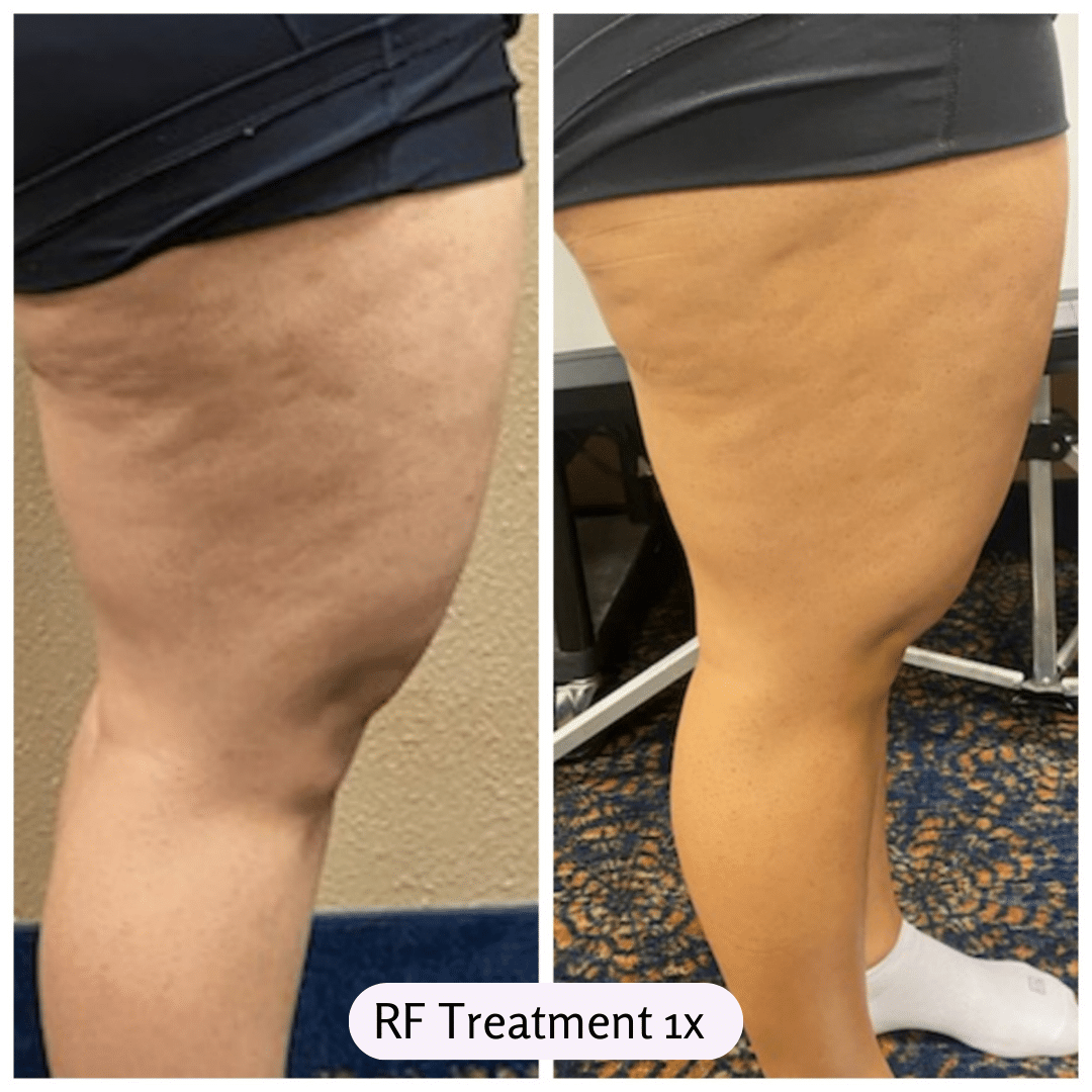 Body Treatment Services | Hands On Healing Spa